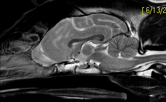 Meningo-encephalomyelitis of Unknown Origin (MUO) - Southfields